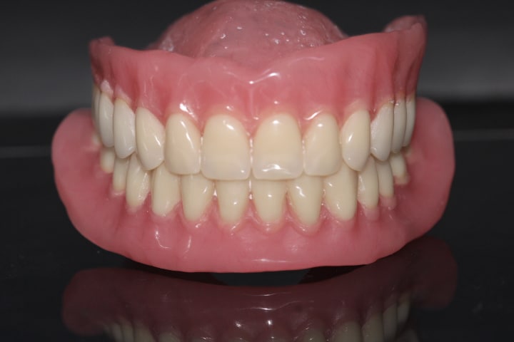 Total Prosthesis (Complete Dentures) - Dental Express México